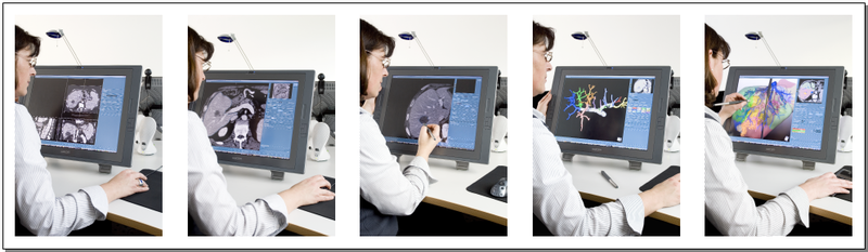 MeVis Medical Solutions AG: MeVis Distant Services (MDS)