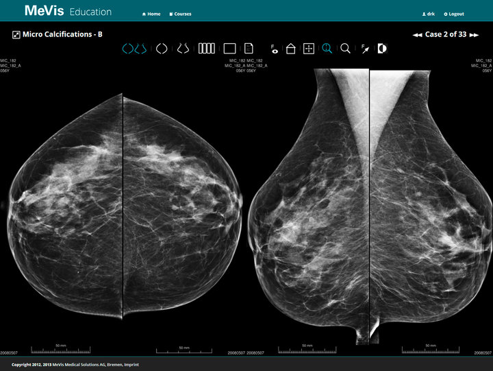 MeVis Medical Solutions AG: MeVis Online Academy