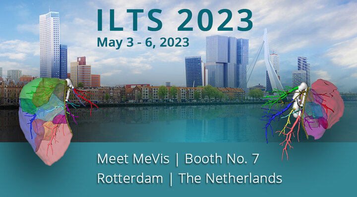 MeVis Medical Solutions AG: ILTS 2023